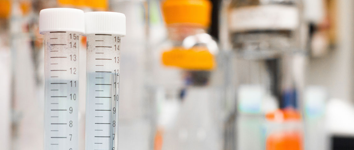 IMMUcan - About the project